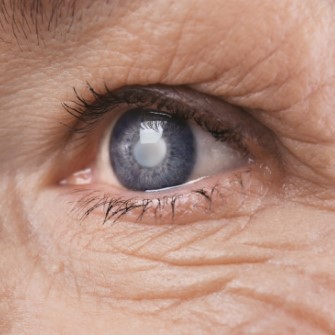 Cloudy vision means you could be suffering from this condition